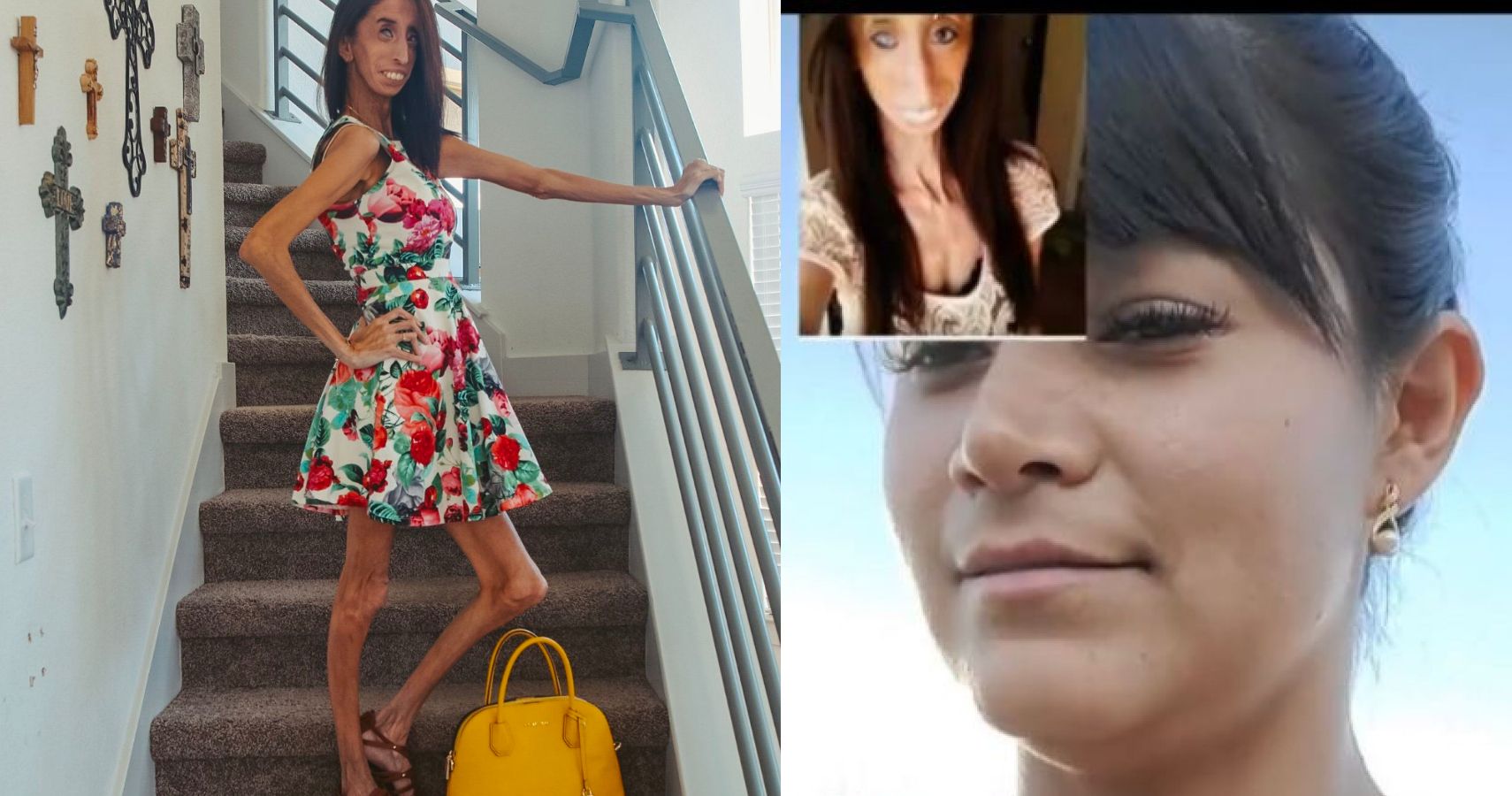 Activist Lizzie Velasquez Shares Words Of Kindness After TikTok Prank